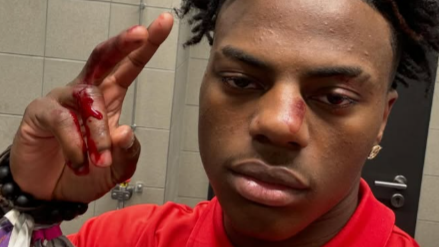 iShowSpeed Faces $1M Lawsuit After Violent Rizzbot Incident ...